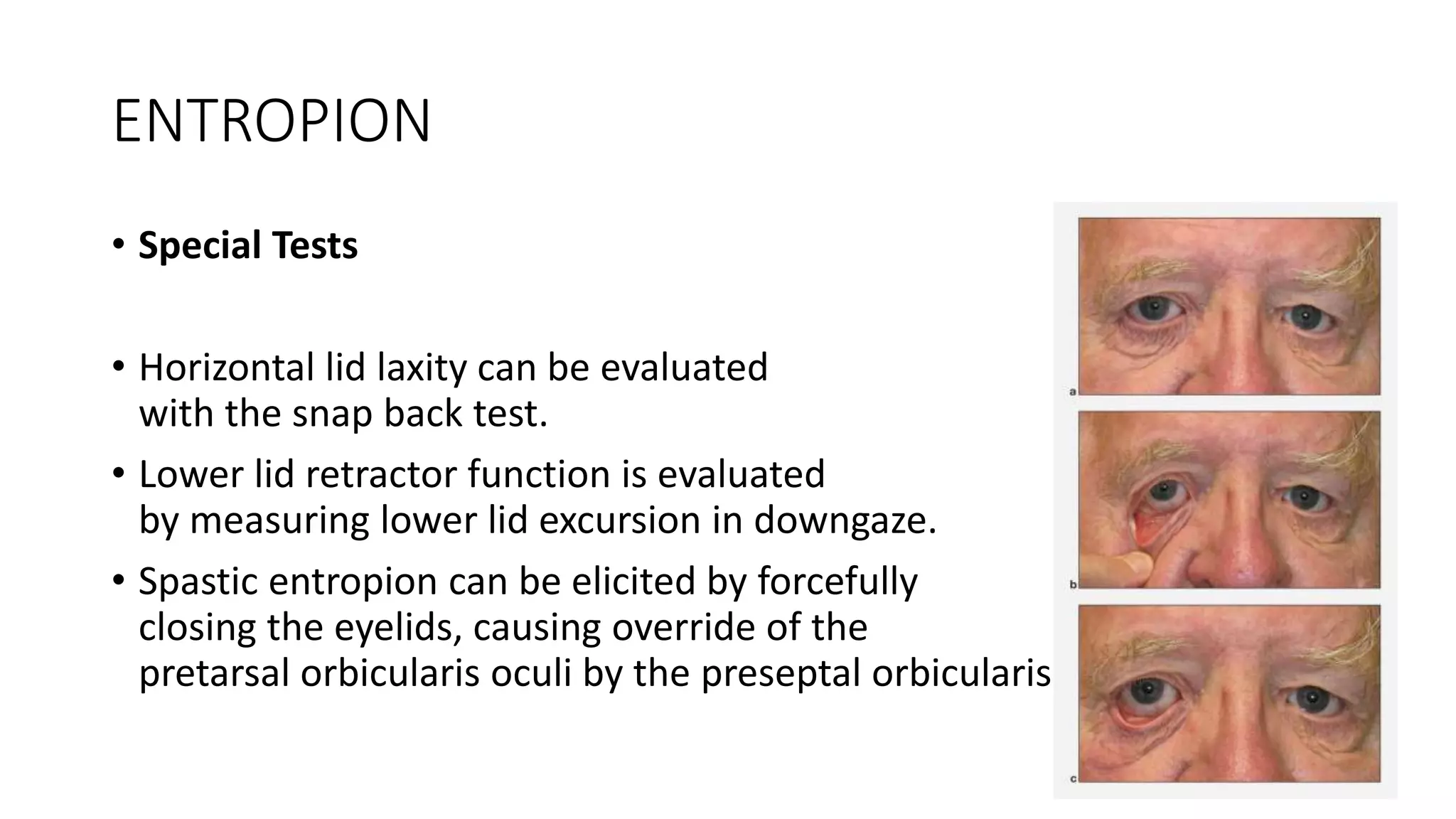 PERIOCULAR MALPOSITIONS AND INVOLUTIONAL CHANGES.pptx