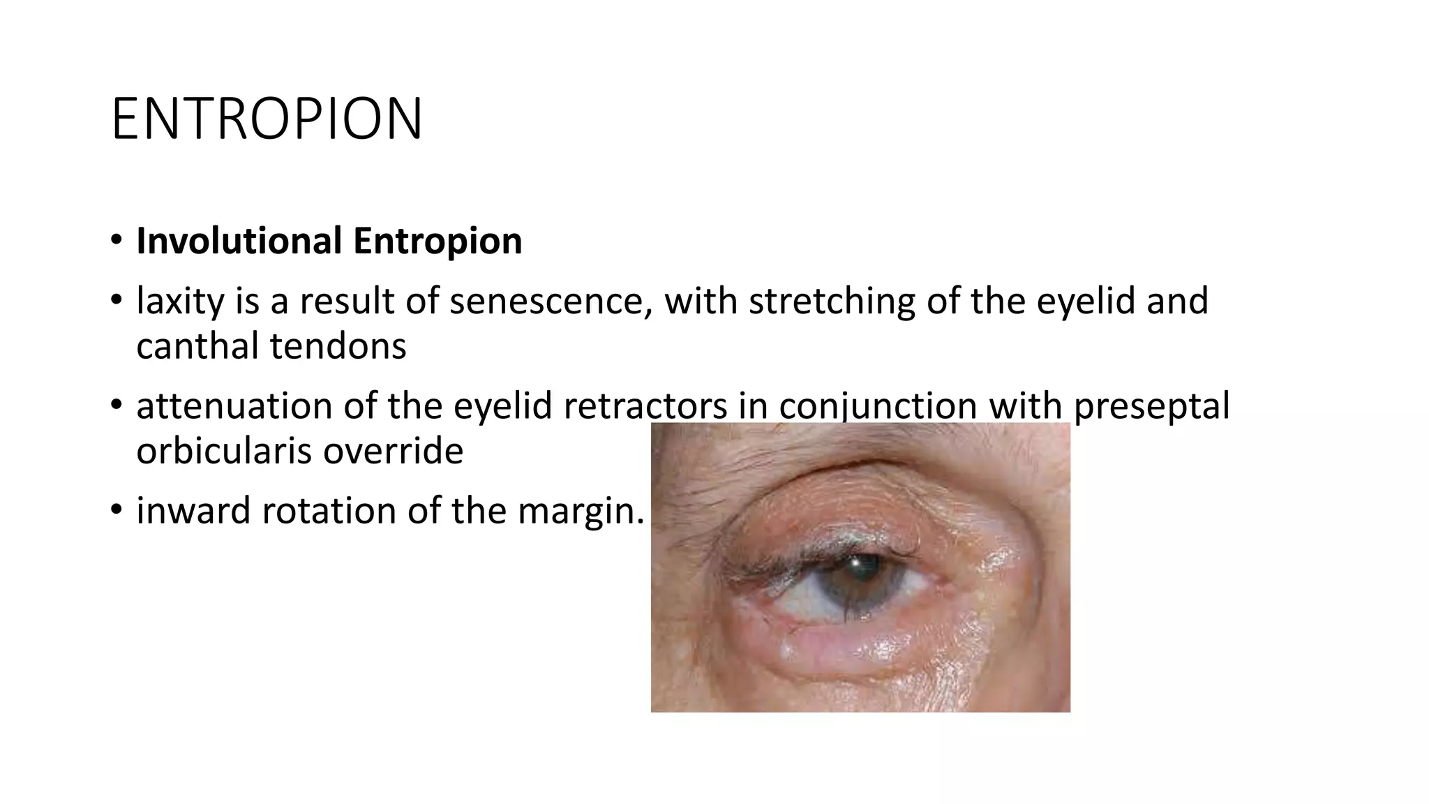 PERIOCULAR MALPOSITIONS AND INVOLUTIONAL CHANGES.pptx