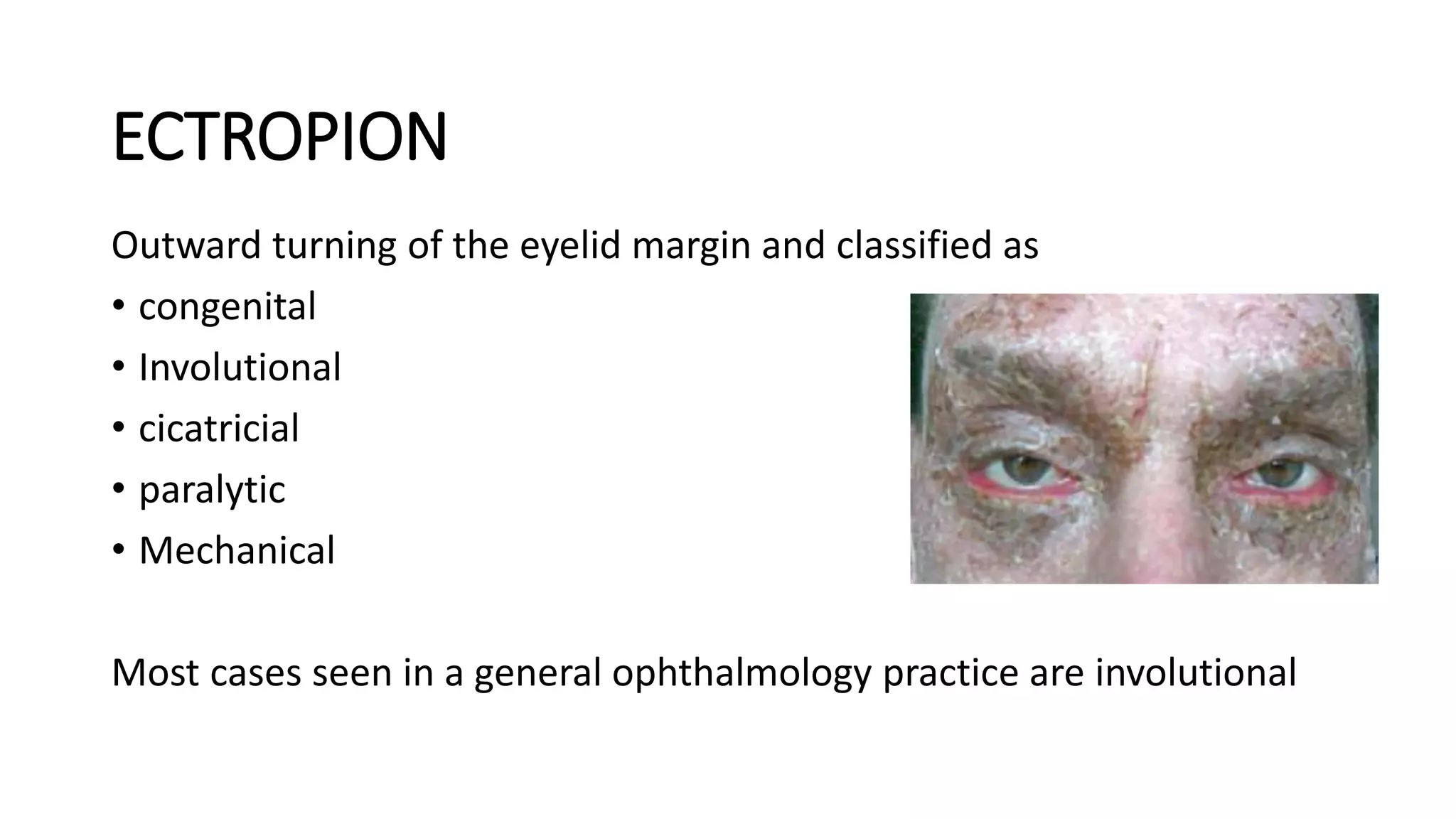 PERIOCULAR MALPOSITIONS AND INVOLUTIONAL CHANGES.pptx