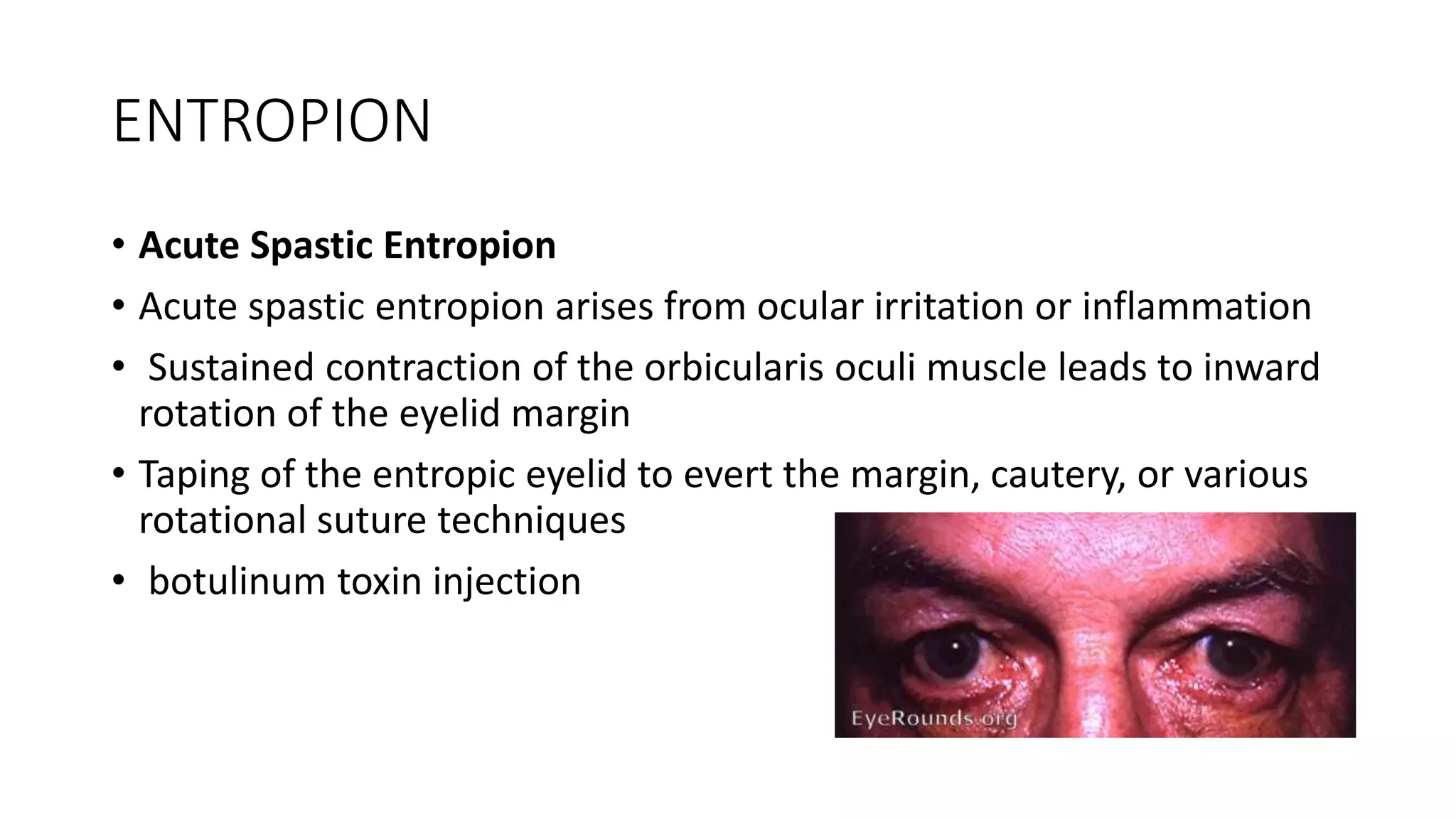 PERIOCULAR MALPOSITIONS AND INVOLUTIONAL CHANGES.pptx