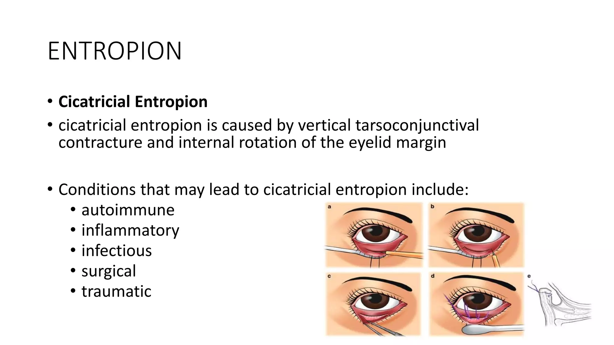 PERIOCULAR MALPOSITIONS AND INVOLUTIONAL CHANGES.pptx
