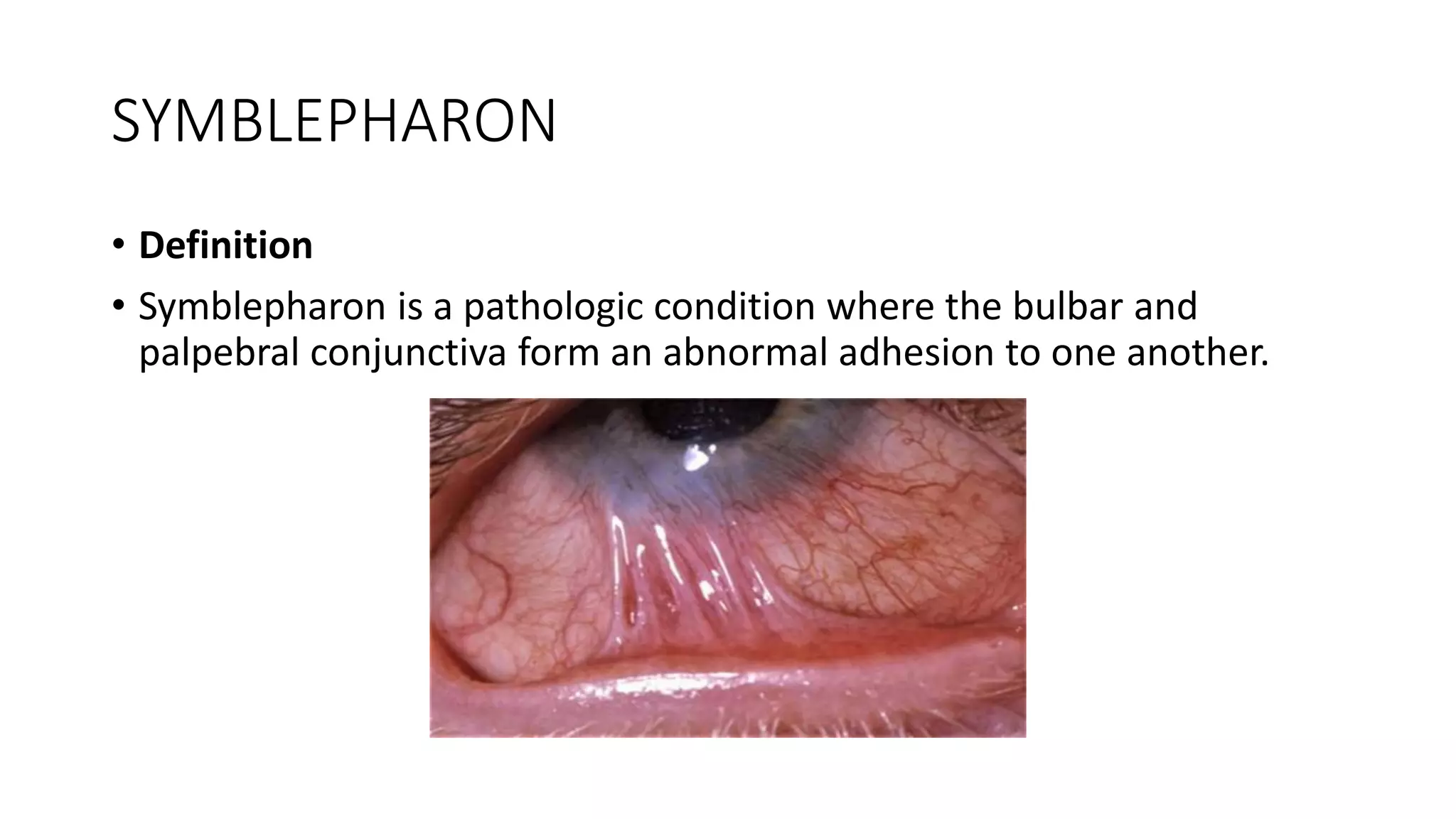 PERIOCULAR MALPOSITIONS AND INVOLUTIONAL CHANGES.pptx