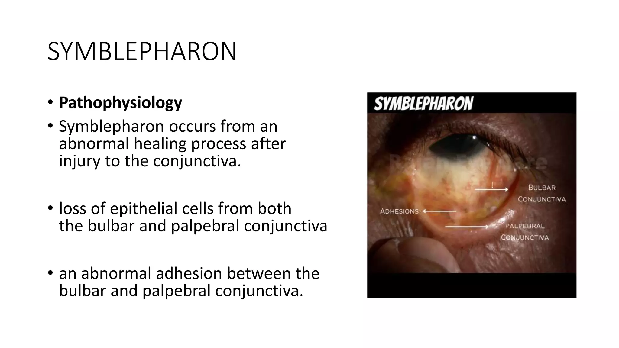 PERIOCULAR MALPOSITIONS AND INVOLUTIONAL CHANGES.pptx