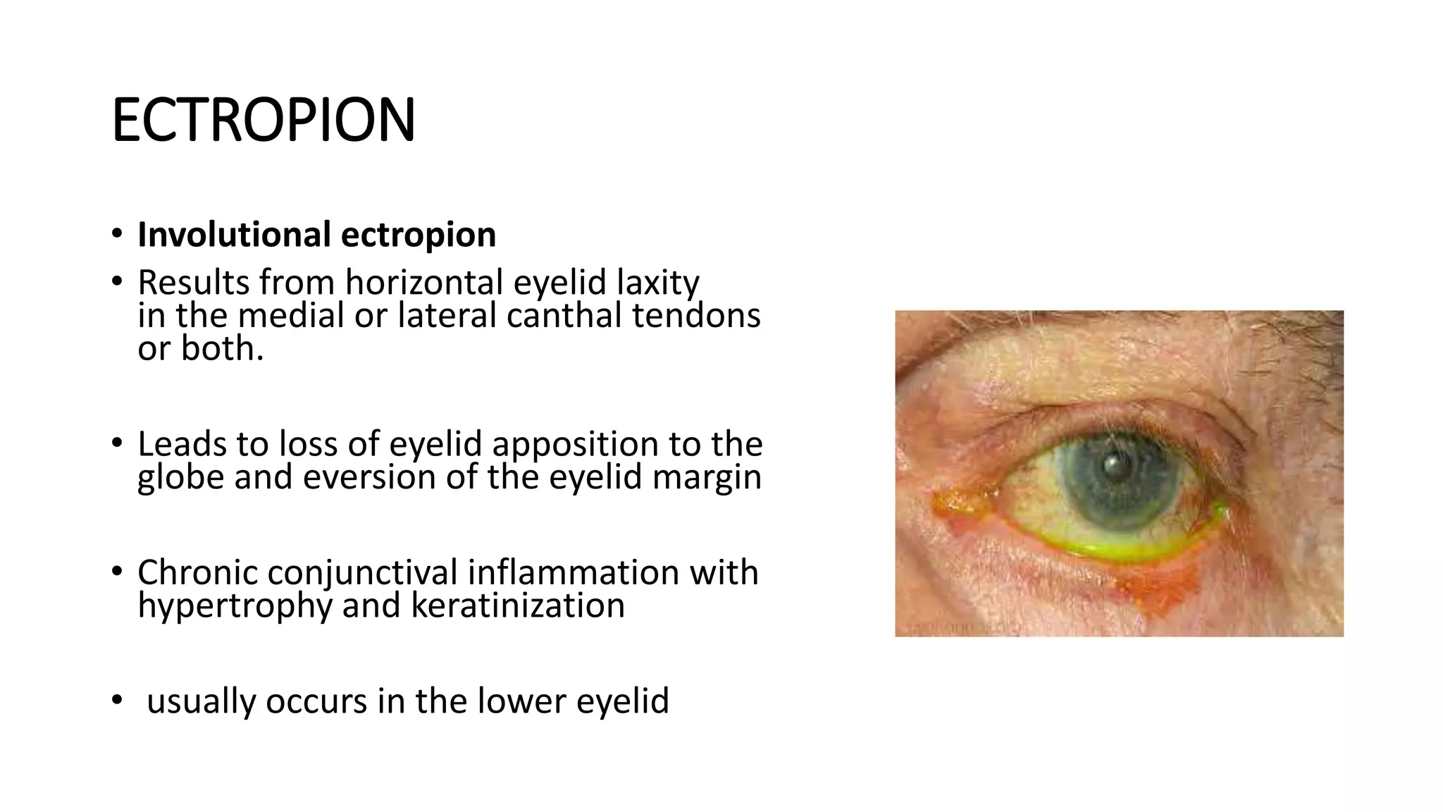 PERIOCULAR MALPOSITIONS AND INVOLUTIONAL CHANGES.pptx