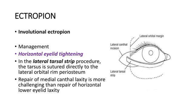PERIOCULAR MALPOSITIONS AND INVOLUTIONAL CHANGES.pptx | Eye and Vision ...