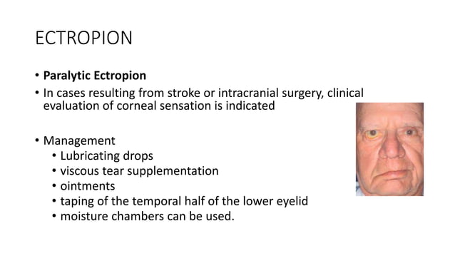 PERIOCULAR MALPOSITIONS AND INVOLUTIONAL CHANGES.pptx | Eye and Vision ...