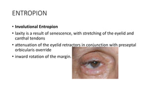 PERIOCULAR MALPOSITIONS AND INVOLUTIONAL CHANGES.pptx