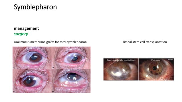 PERIOCULAR MALPOSITIONS AND INVOLUTIONAL CHANGES.pptx | Eye and Vision ...