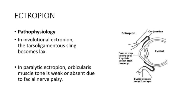 PERIOCULAR MALPOSITIONS AND INVOLUTIONAL CHANGES.pptx | Eye and Vision ...