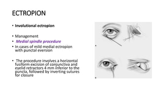 PERIOCULAR MALPOSITIONS AND INVOLUTIONAL CHANGES.pptx