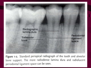 Periodontal Ligament Space
