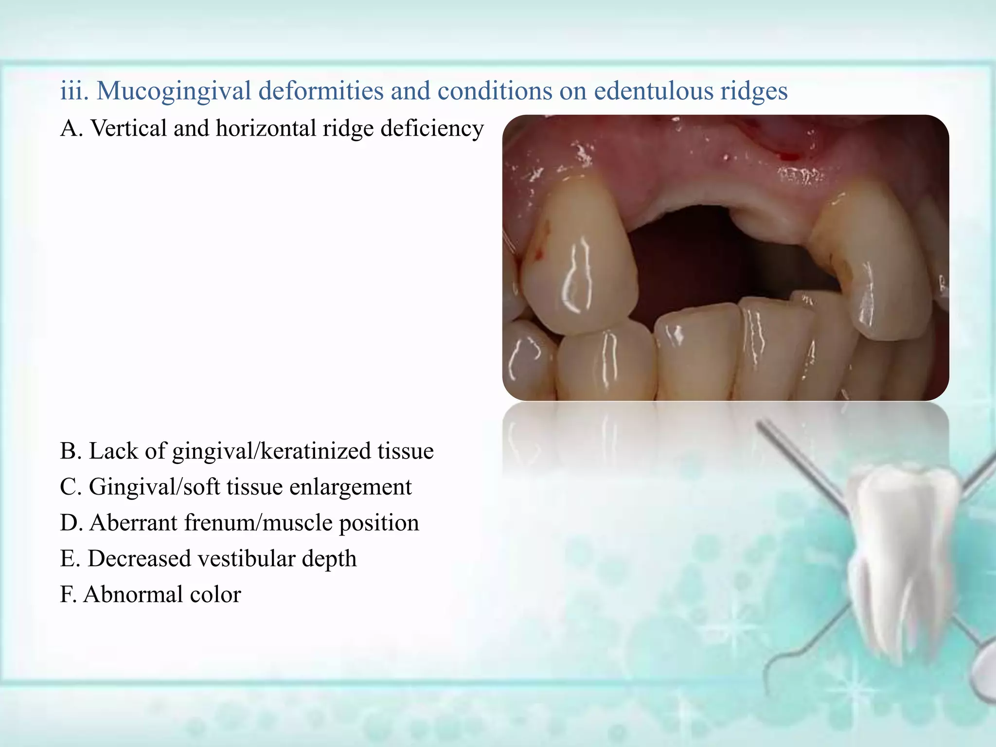 Classification of periodontal diseases and conditions past and present ...