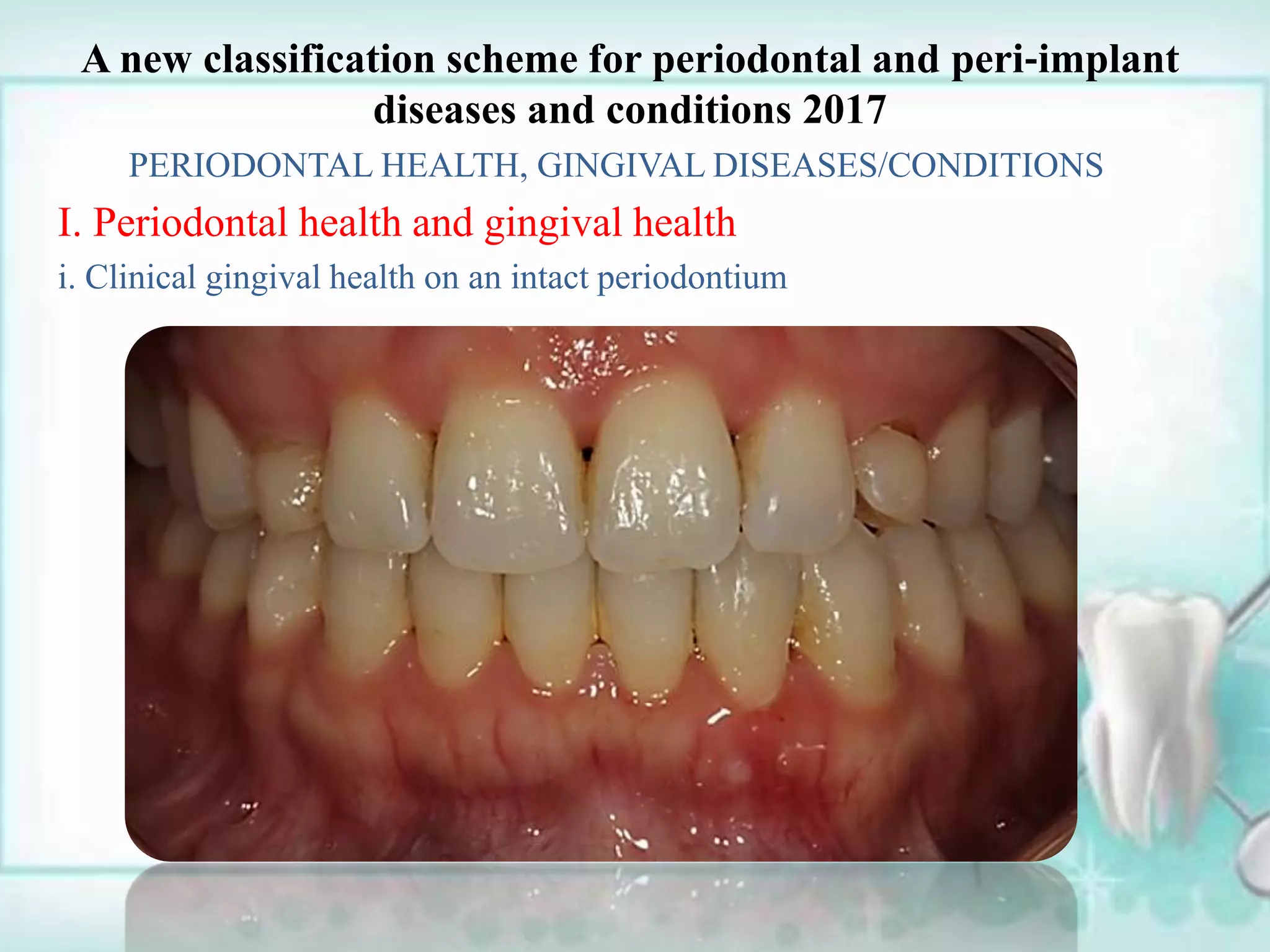 Classification of periodontal diseases and conditions past and present ...