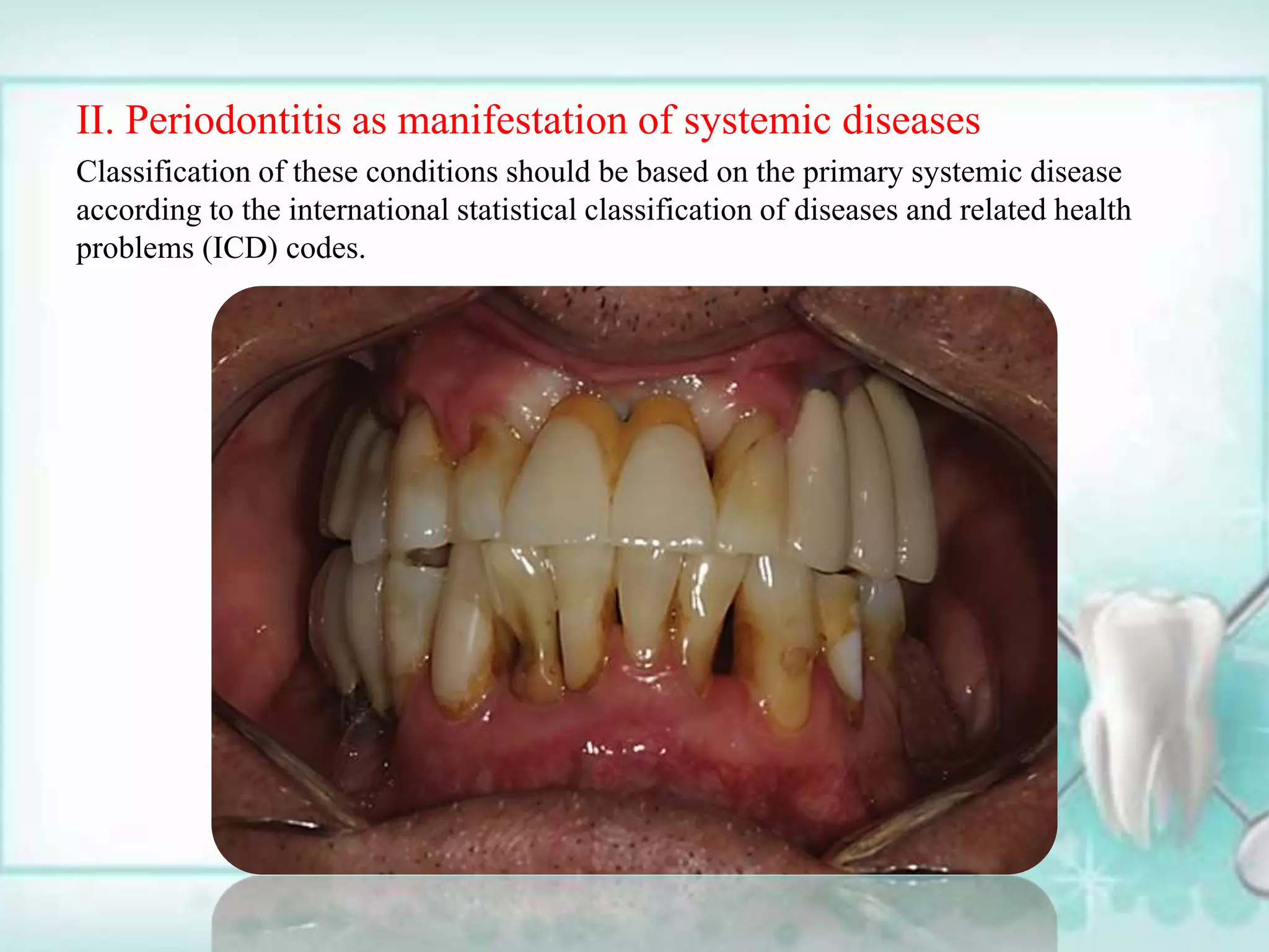 Classification of periodontal diseases and conditions past and present ...