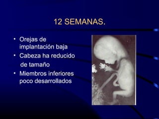 Periodo fetal y malformaciones | PPT