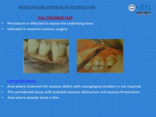 PERIODONTAL.pdf. Perio.flap.surgery.periodontics | PDF