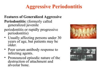 Periodontal-Diseases-III.ppt classification) | PPT