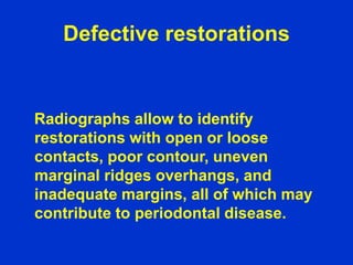 Periodontal 3diseases dr. Al-Ass.ppt