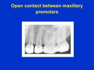 Periodontal 3diseases dr. Al-Ass.ppt
