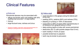 Periodontal abcess in dentistry concise view.pptx