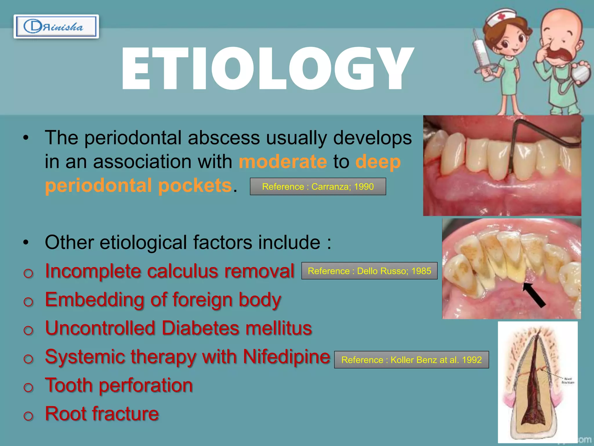Periodontal Abscess | PPTX