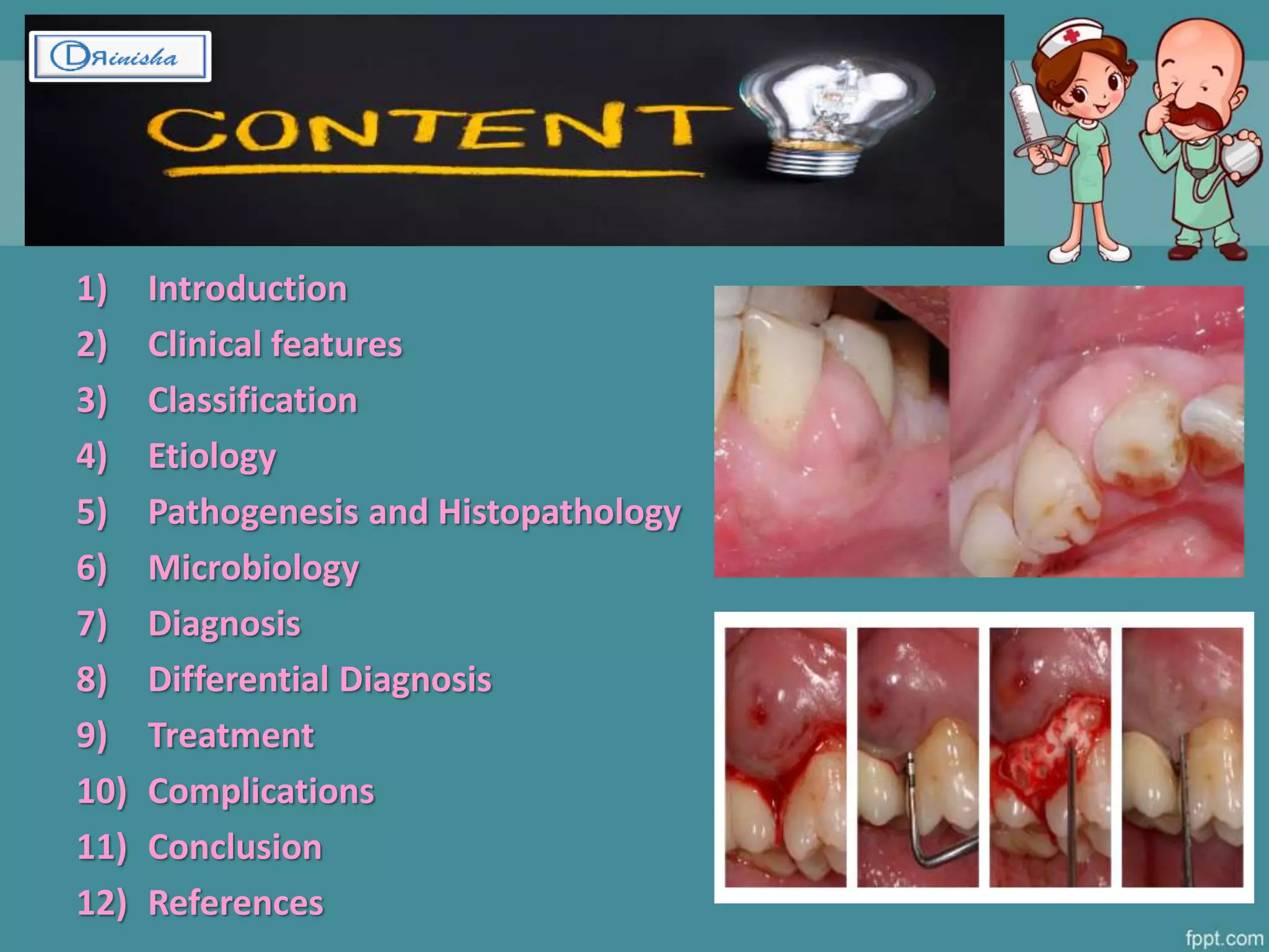 Periodontal Abscess | PPTX
