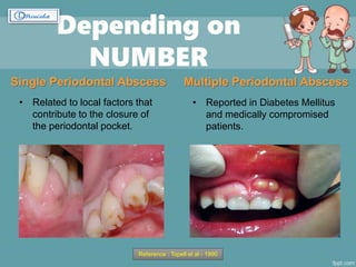 Periodontal Abscess | PPTX | Dental Health | Diseases and Conditions