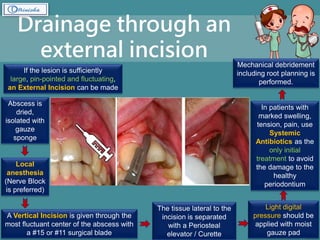 Periodontal Abscess | PPT