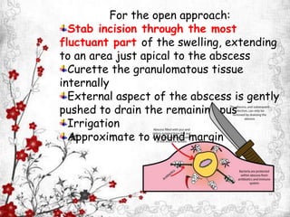 Periodontal abscess | PPTX