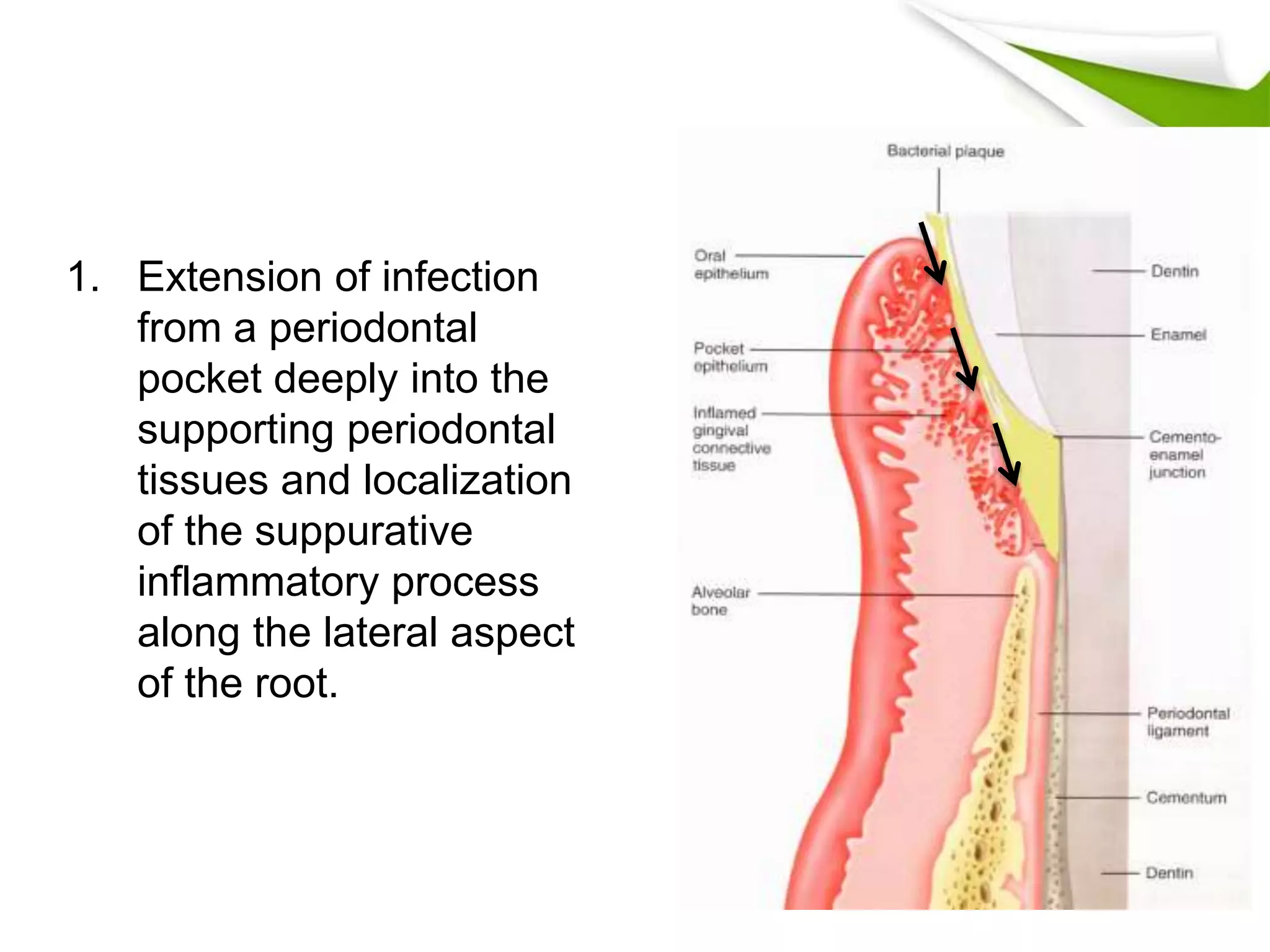 Periodontal abscess.pptx | Dental Health | Diseases and Conditions