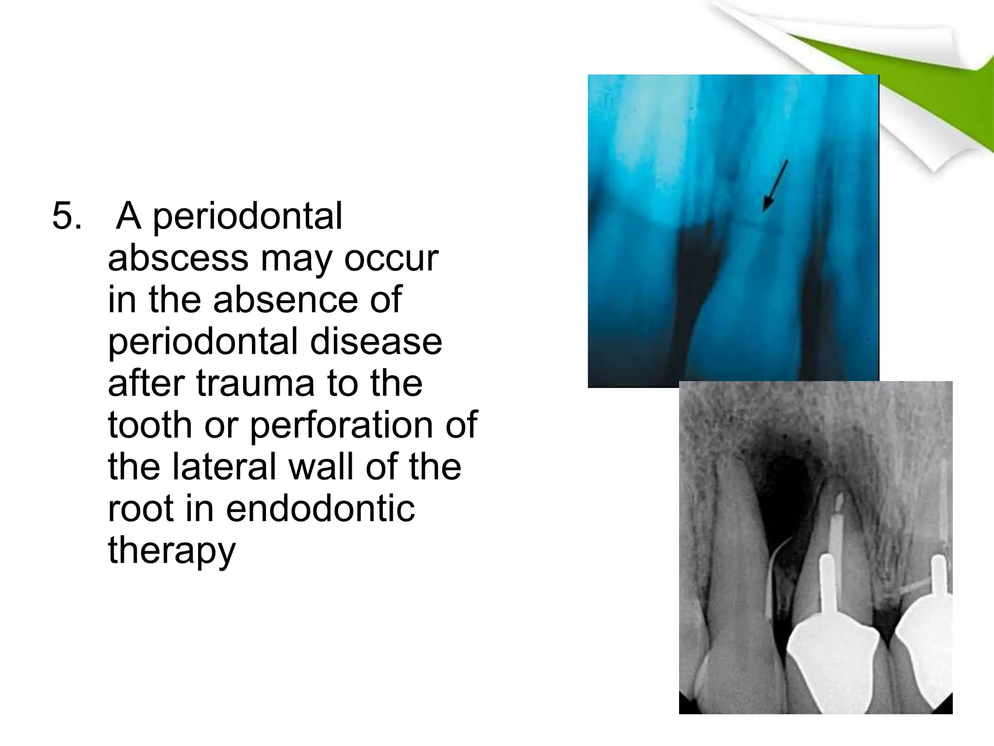 Periodontal abscess.pptx