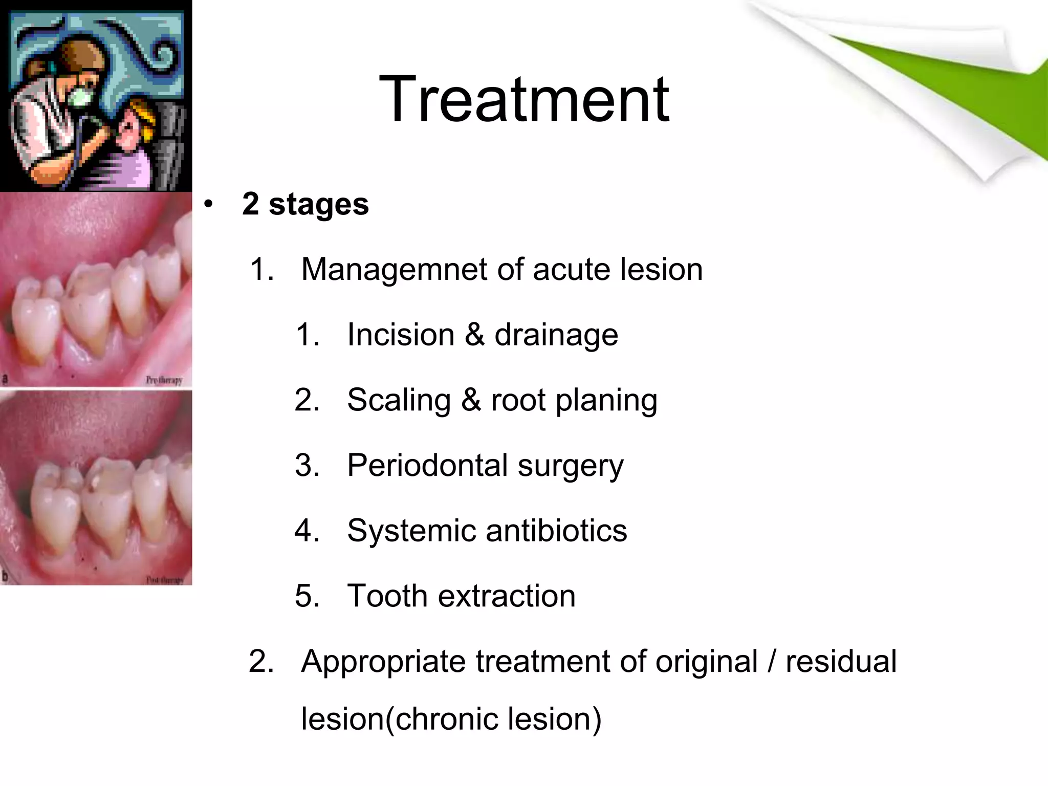 Periodontal abscess.pptx