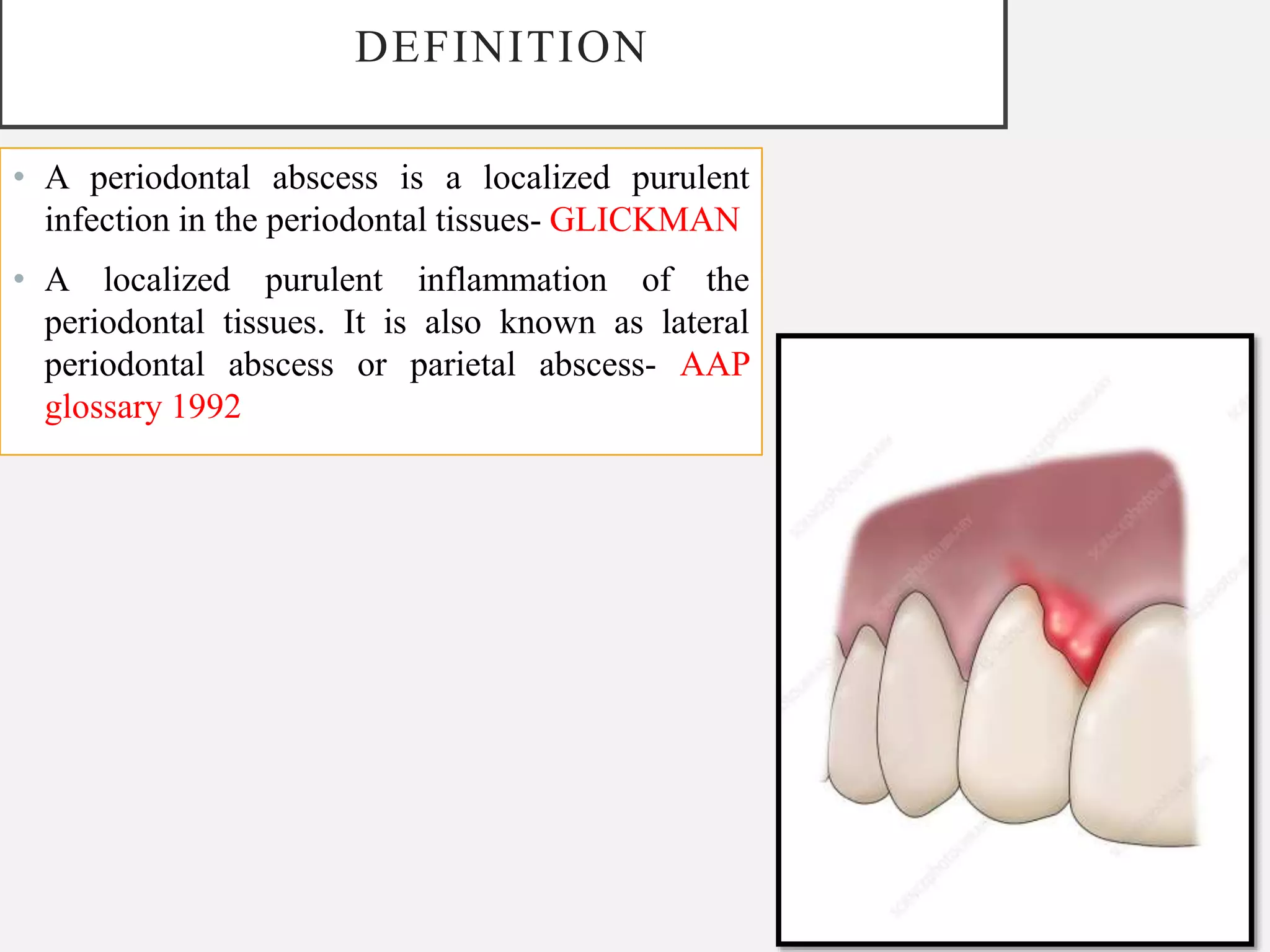 Periodontal abscess.pptx