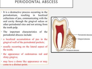 Periodontal abscess.pptx