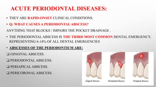 periodontal abscess.pptx