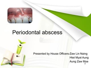 periodontal abscess etiology pathogenesis | PPTX