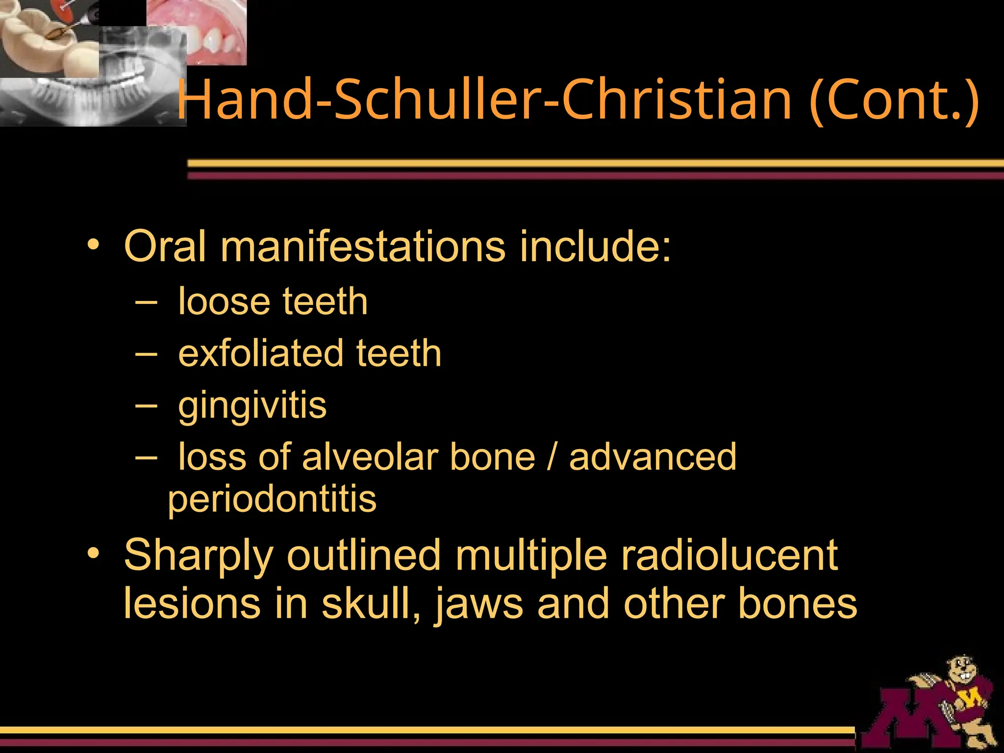 Periodontal and Periapical Diseases - PPT | PPT
