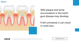 Periodontal Cleaning | PPT