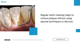 Periodontal Cleaning | PPT