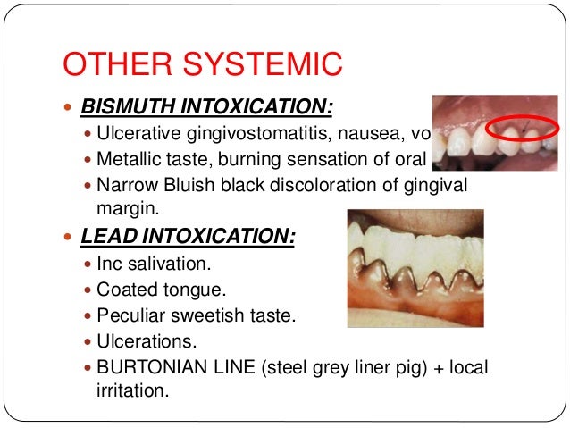 Periodontal conditions of medically comprmised patients