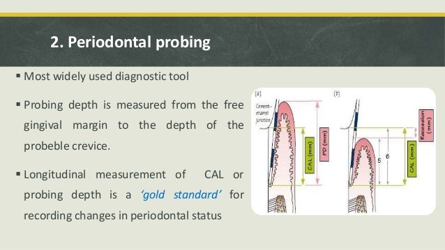 Advanced Periodontal diagnostic aids