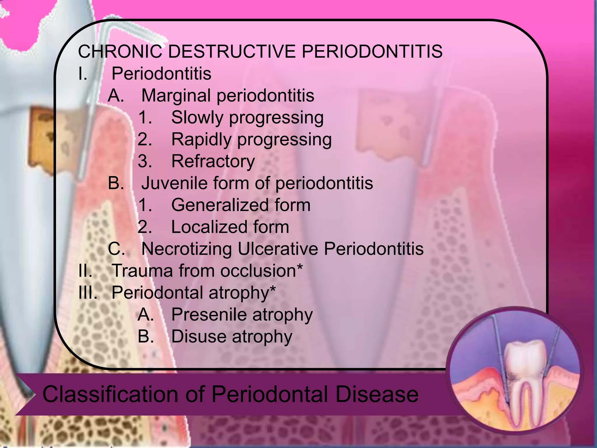 Periodontal disease | PPTX