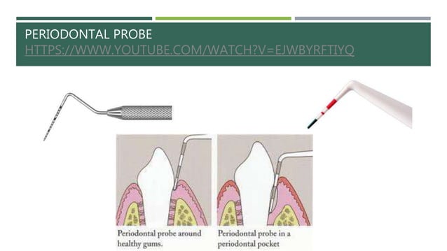 Periodontal Disease PowerPoint | PPTX