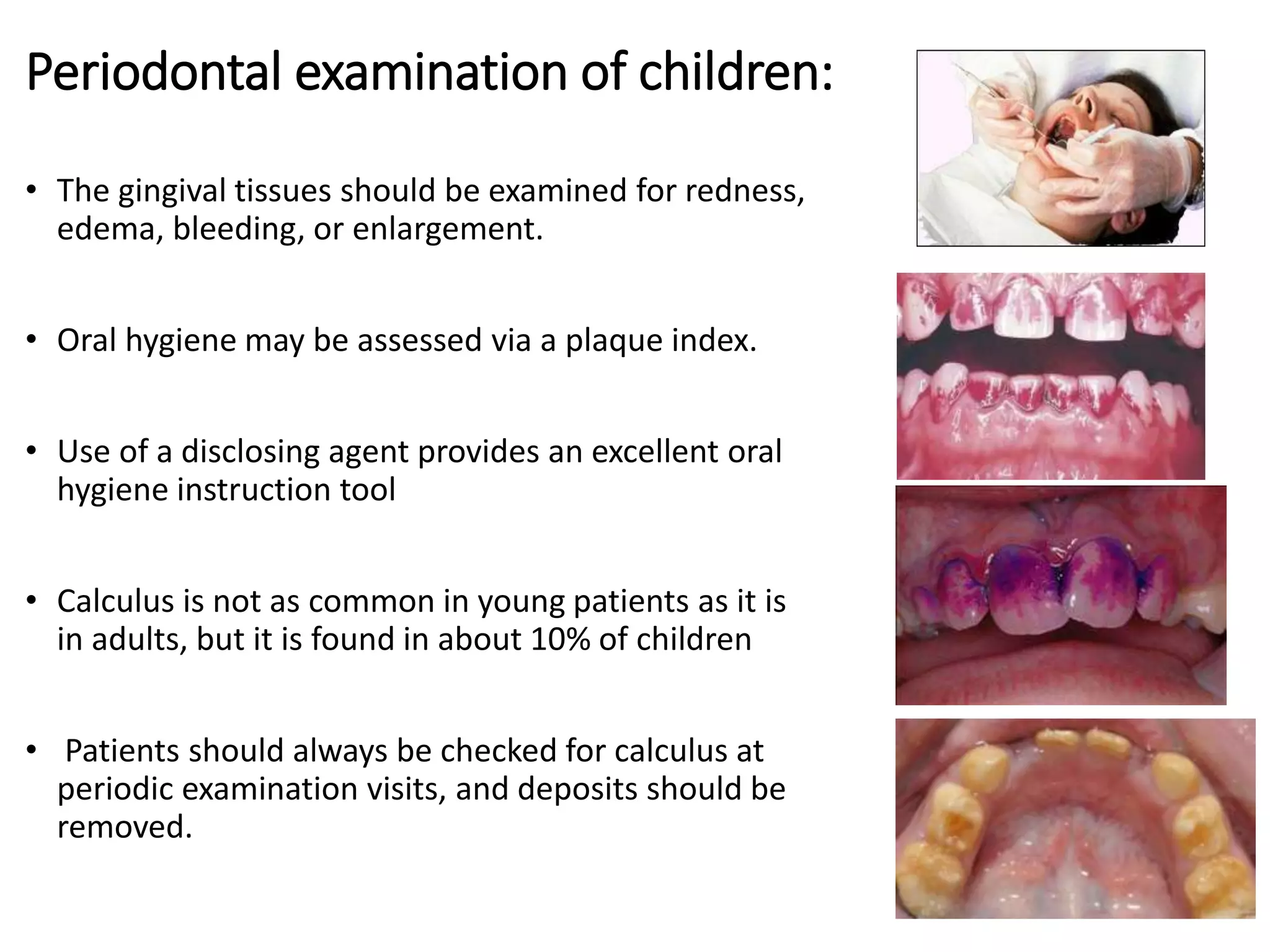 Periodontal disease in children -pedodontics | PPTX