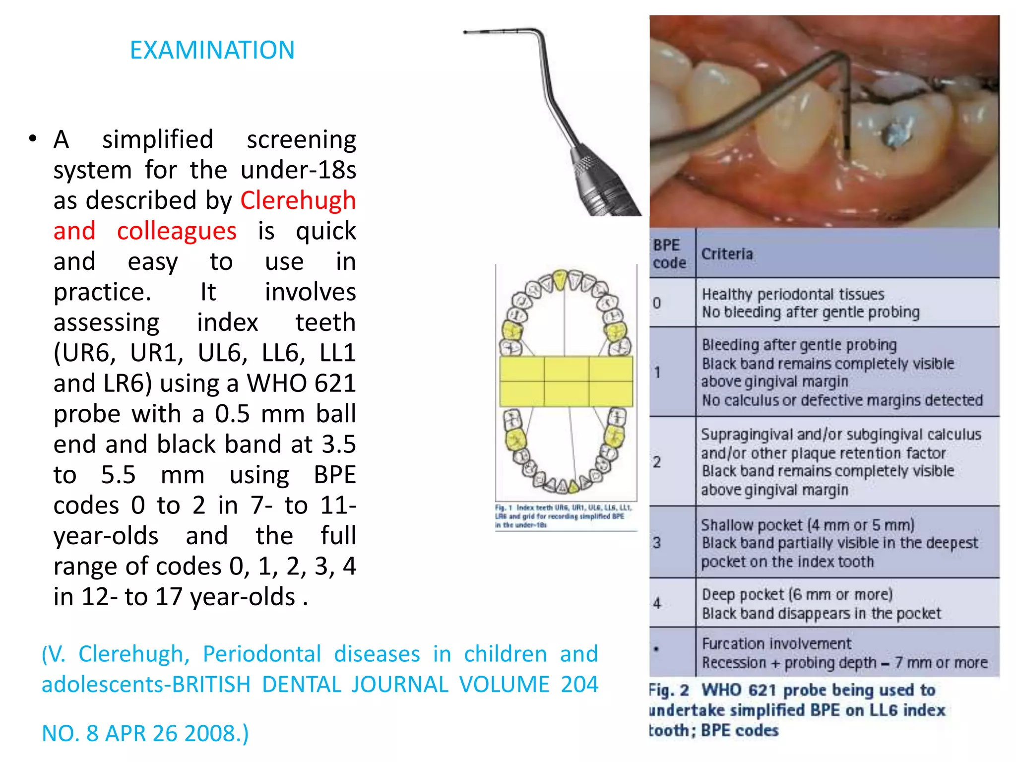 Periodontal disease in children -pedodontics | PPTX