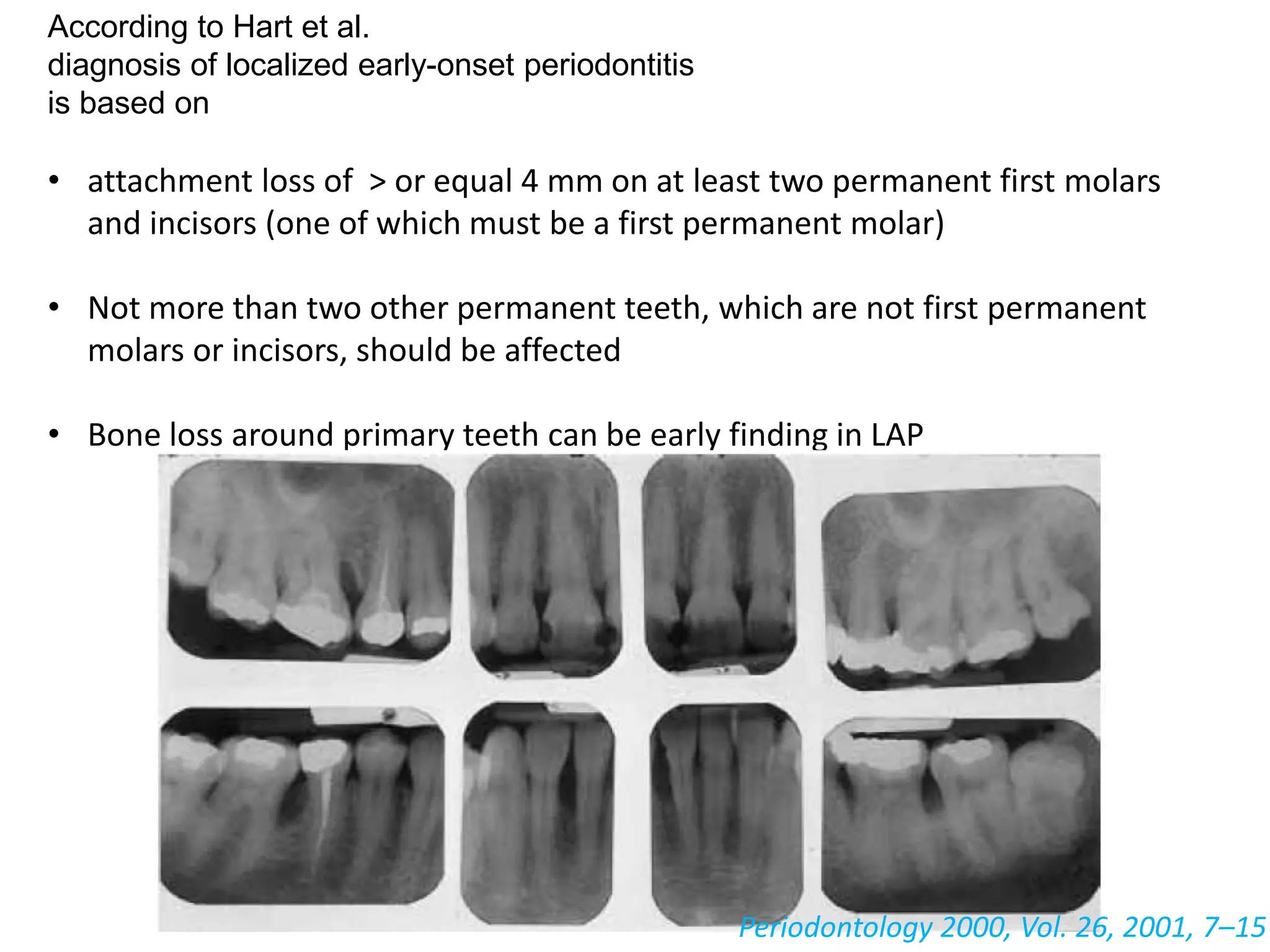 Periodontal disease in children -pedodontics | PPTX