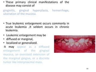 Periodontal disease in children -pedodontics | PPTX