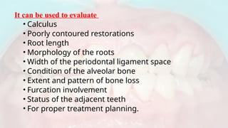 PERIODONTAL DISEASES- RADIOLOGICAL FINDINGS | PPTX