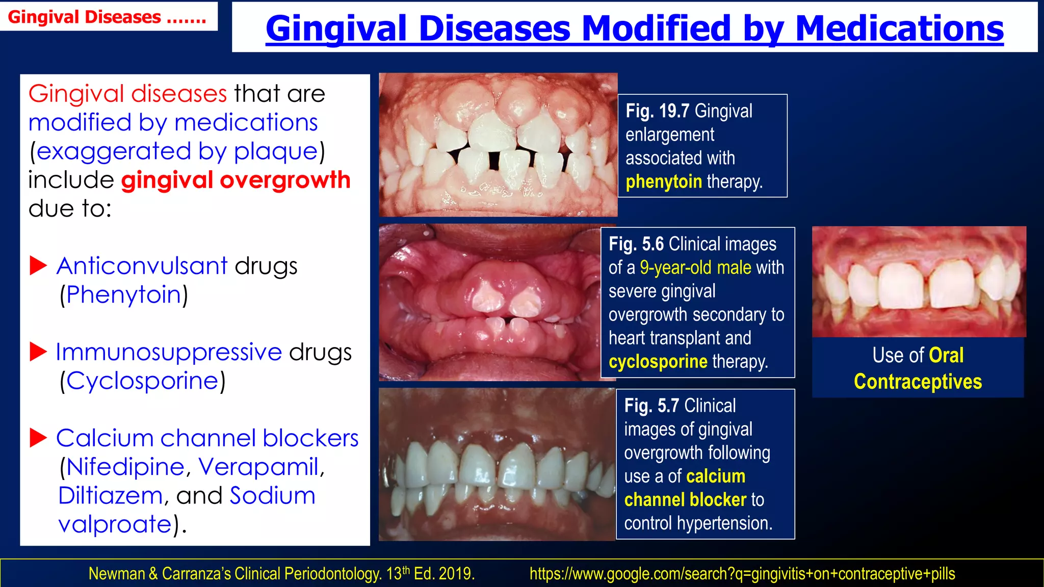 Periodontal diseases Classifications and treatments | PDF