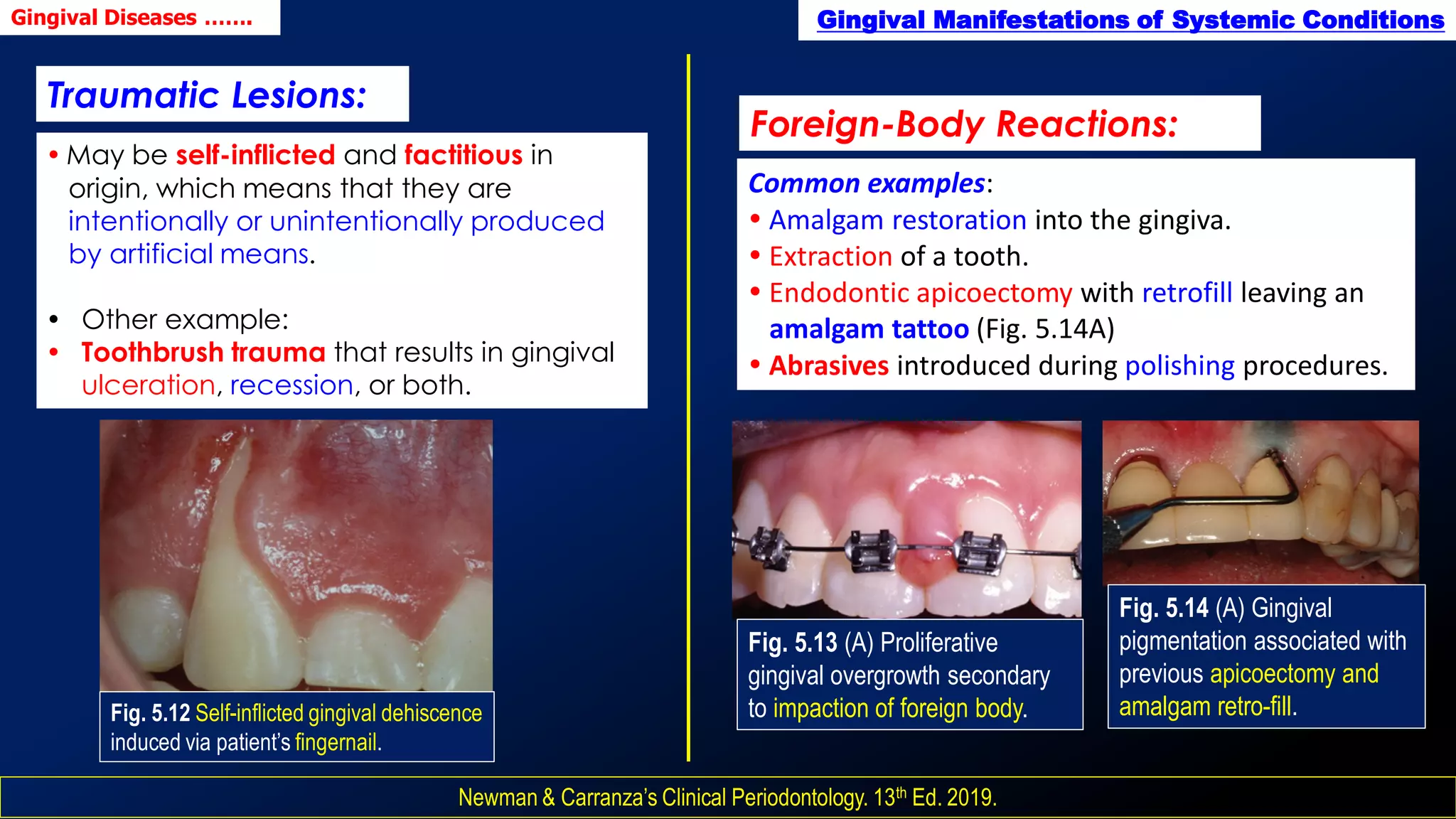 Periodontal diseases Classifications and treatments | PDF